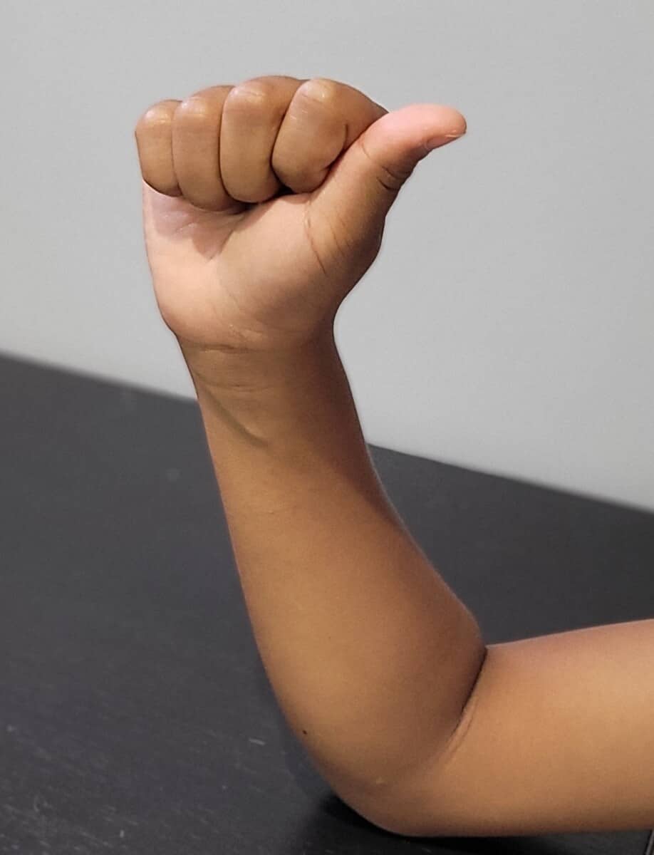 Enhancing Hand Strength Through Stretching Exercises – Mechanics of OT